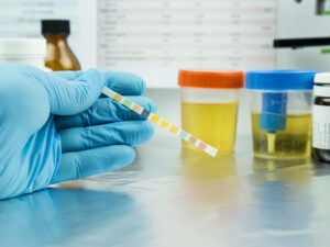 İdrar rengi ne anlatıyor? Neden koyu olur? İşte idrar rengi anlamları